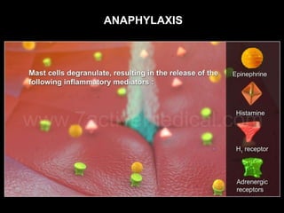 Anaphylaxis | PPT
