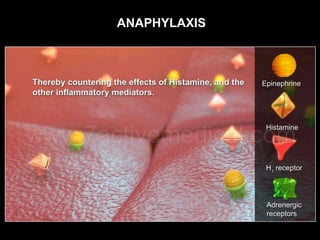 Anaphylaxis | PPT