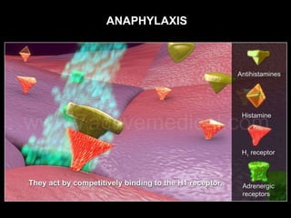 Anaphylaxis | PPT