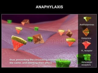 Anaphylaxis | PPTX