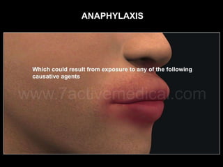 Anaphylaxis | PPTX