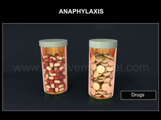 Anaphylaxis | PPTX