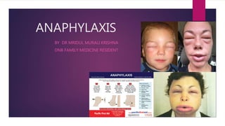 Anaphylaxis | PPTX