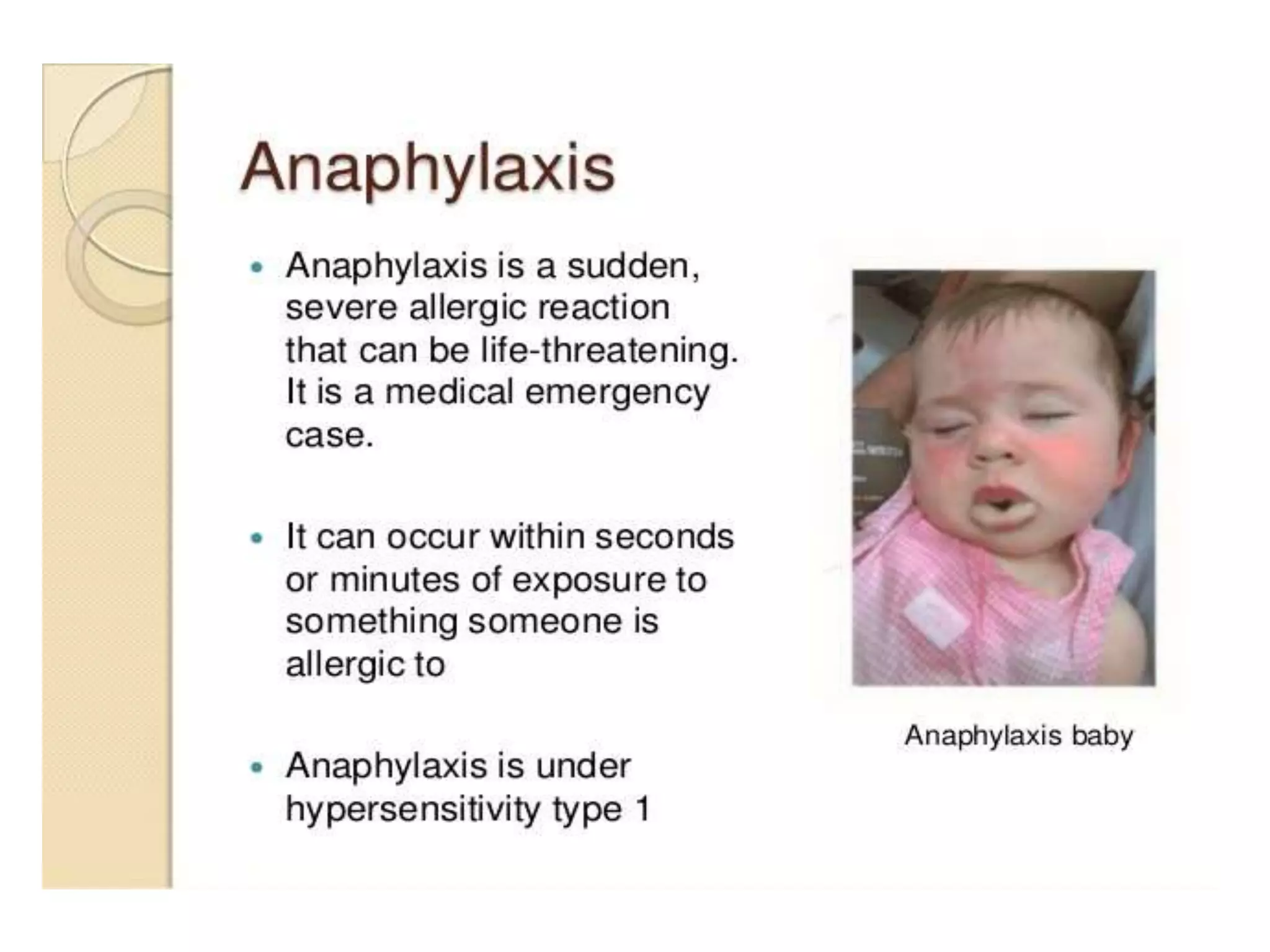 Anaphylaxis | PPTX