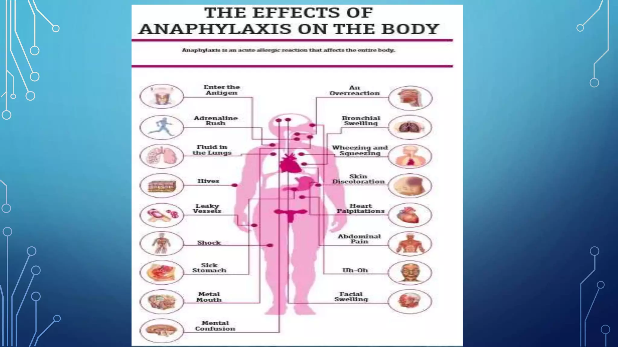Anaphylaxis | PPTX