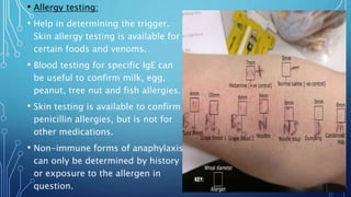 Anaphylaxis | PPT