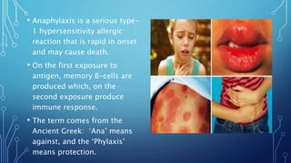 Anaphylaxis | PPTX