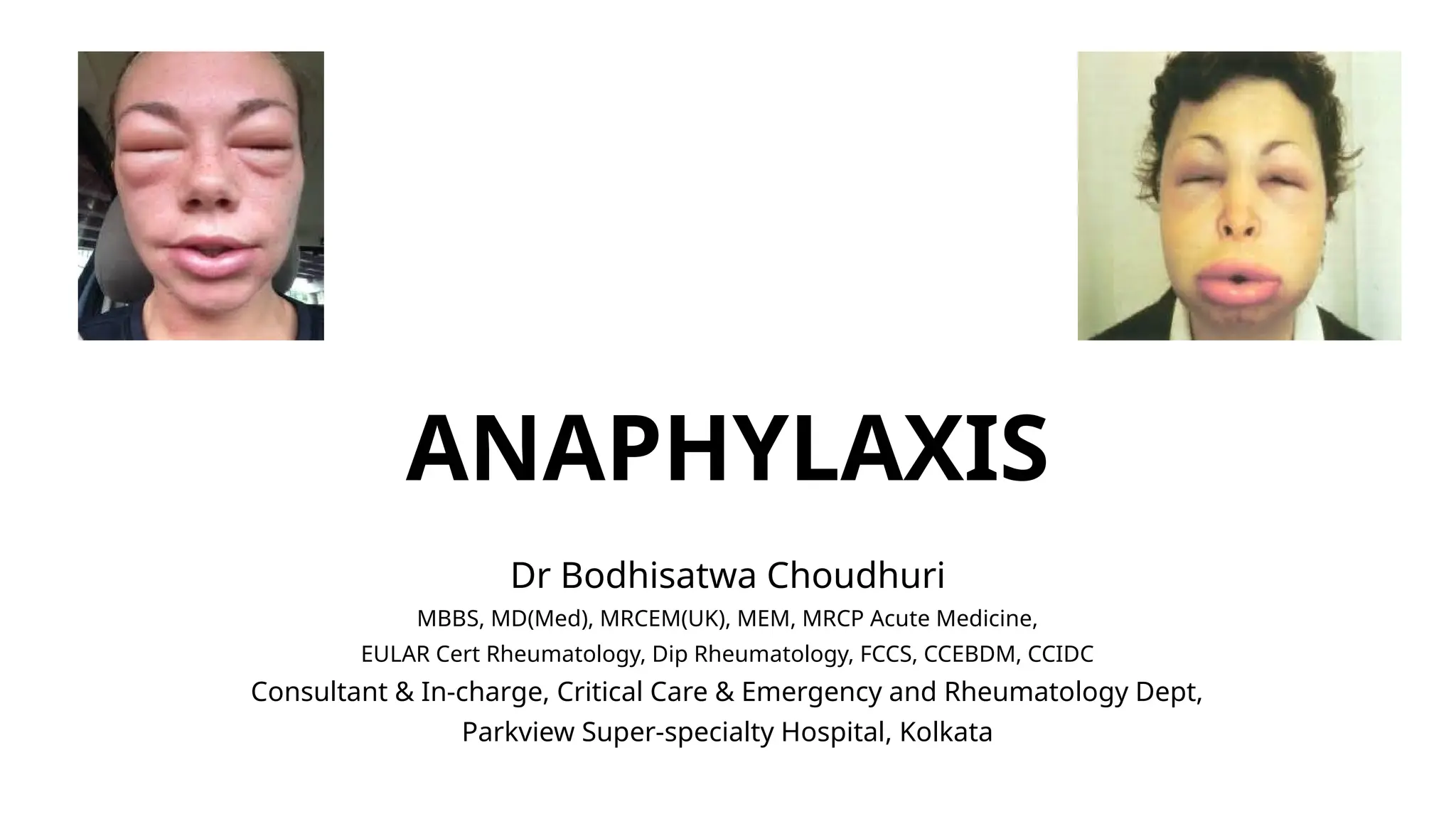 "Anaphylaxis Explained: A Practical Overview for Healthcare ...