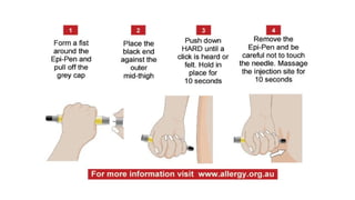 "Anaphylaxis Explained: A Practical Overview for Healthcare ...