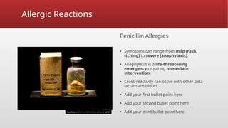 Pre Simulation Nursing Care of Allergic Reaction | PPTX