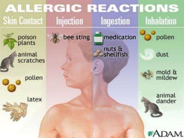 Anaphylaxis and anesthesia | PPTX | Allergies | Diseases and Conditions