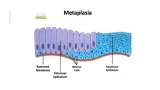ANAPLASIA, DISPLASIA, METAPLASIA.pptx