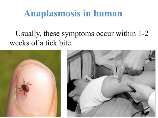 Anaplasmosis | PDF