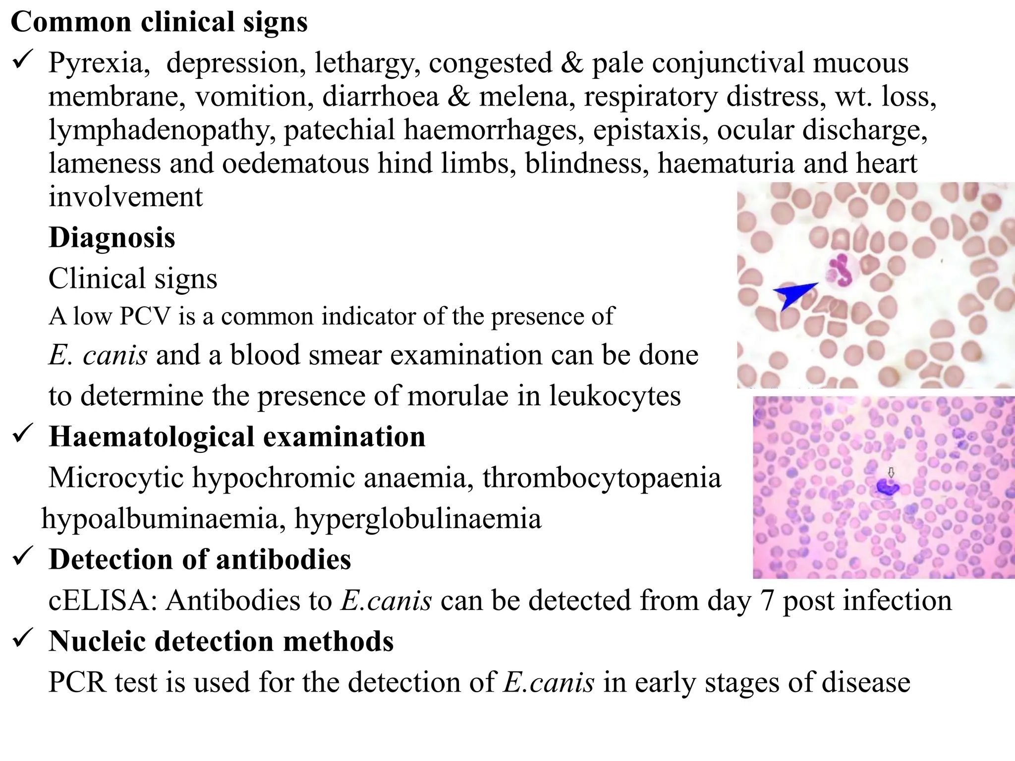 Anaplasmosis and Ehverygoodrlichiosis.pptx