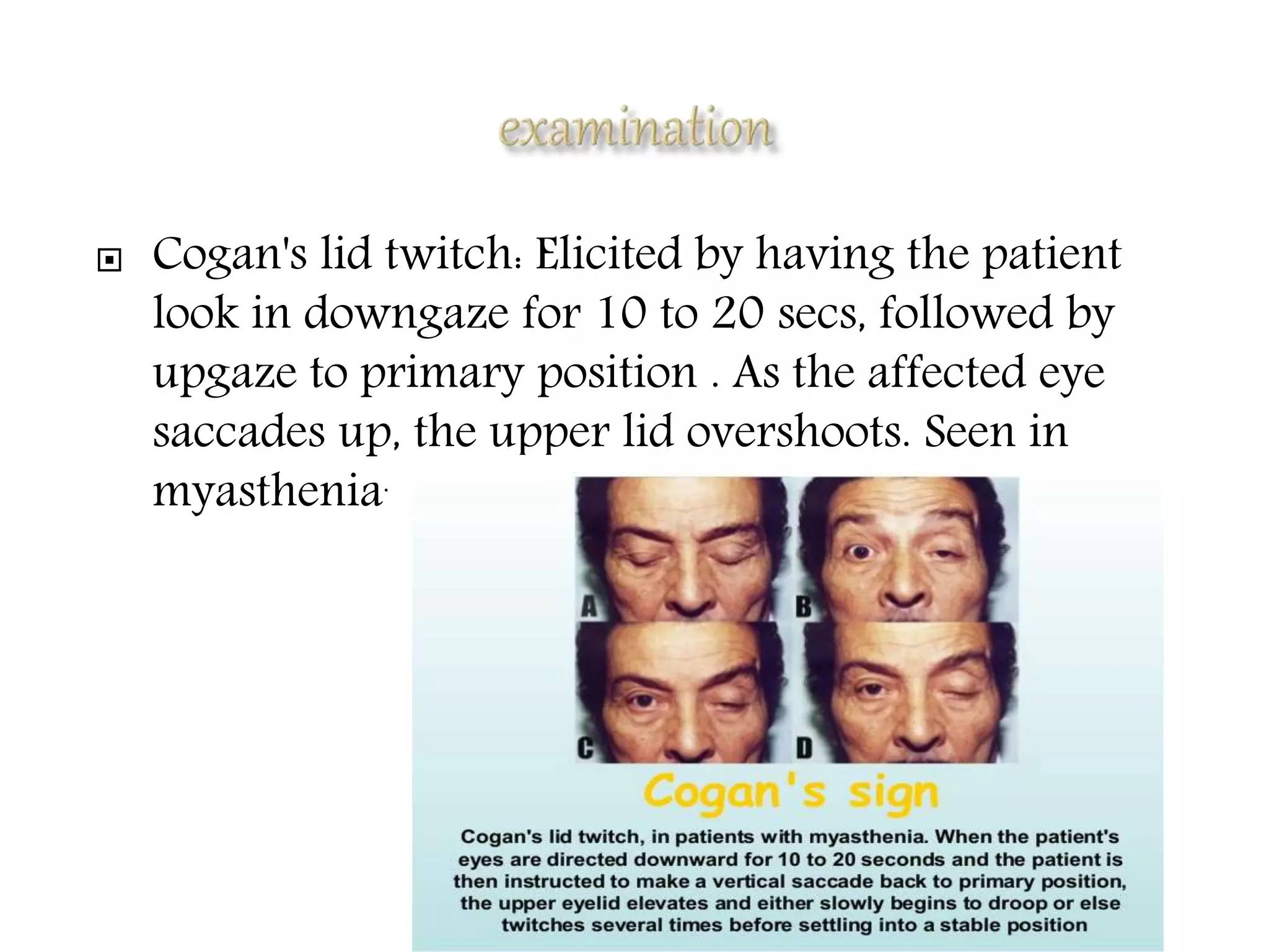 An approach to a case of ptosis | PPTX