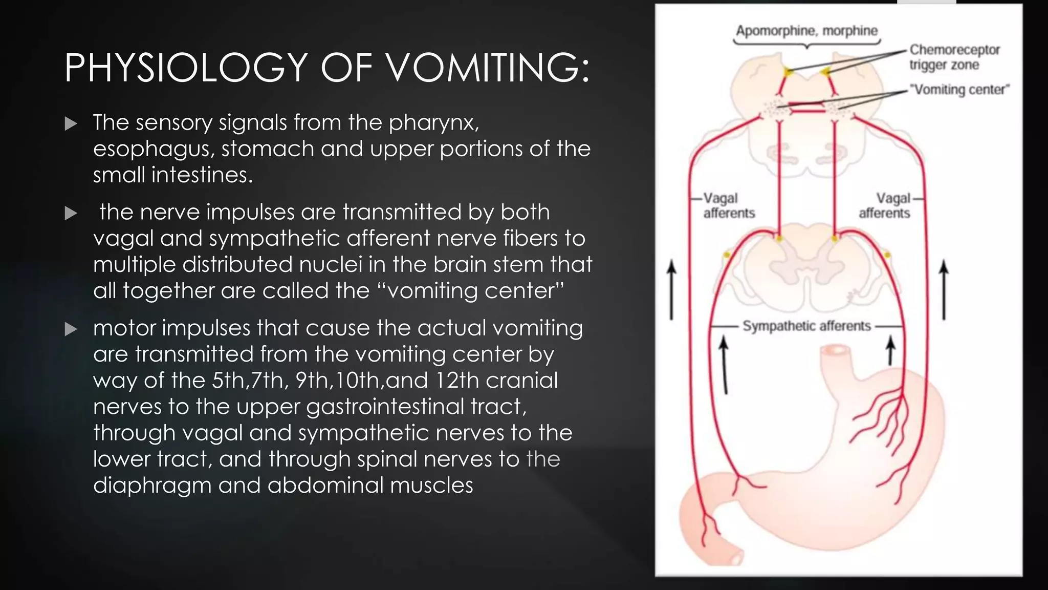 An approach to a case of vomiting in children | PPTX