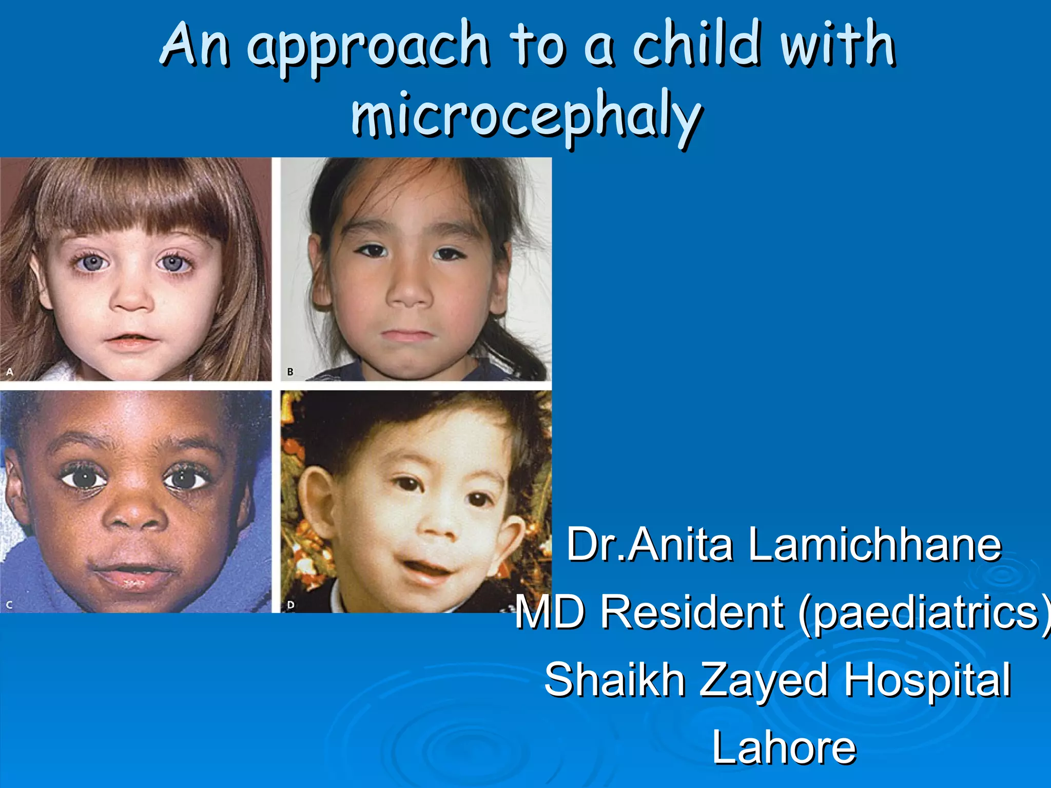 An approach to a chil with microcephaly | PPT