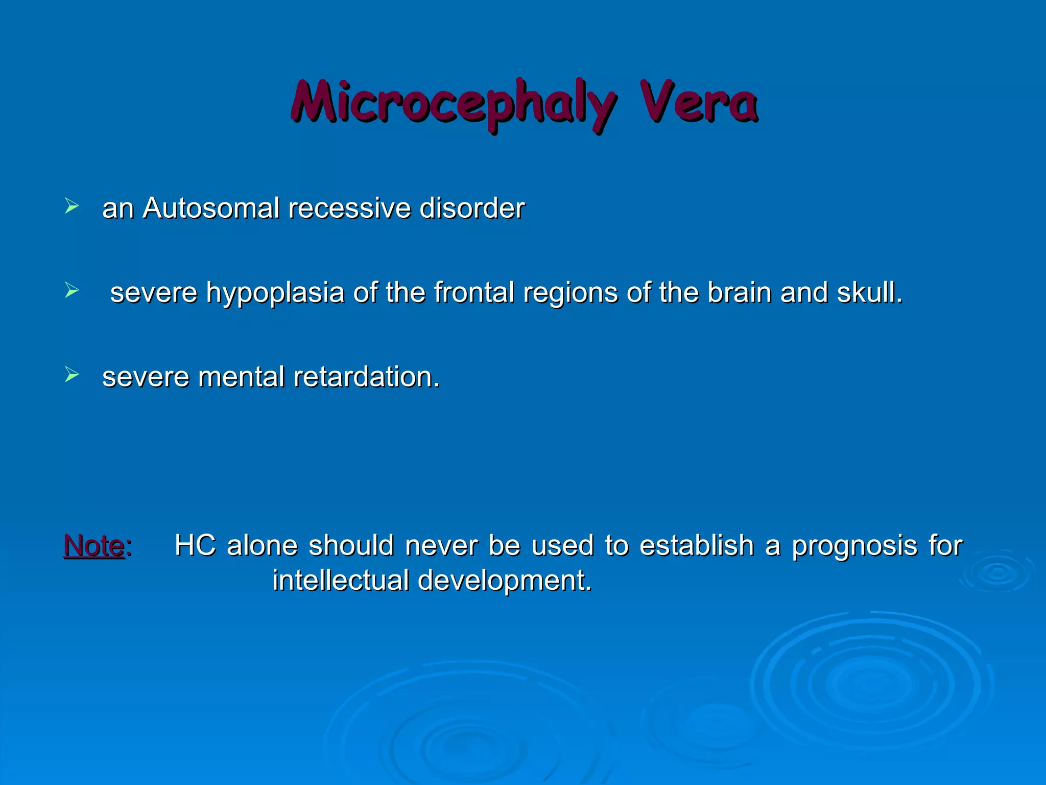 An approach to a chil with microcephaly | PPT