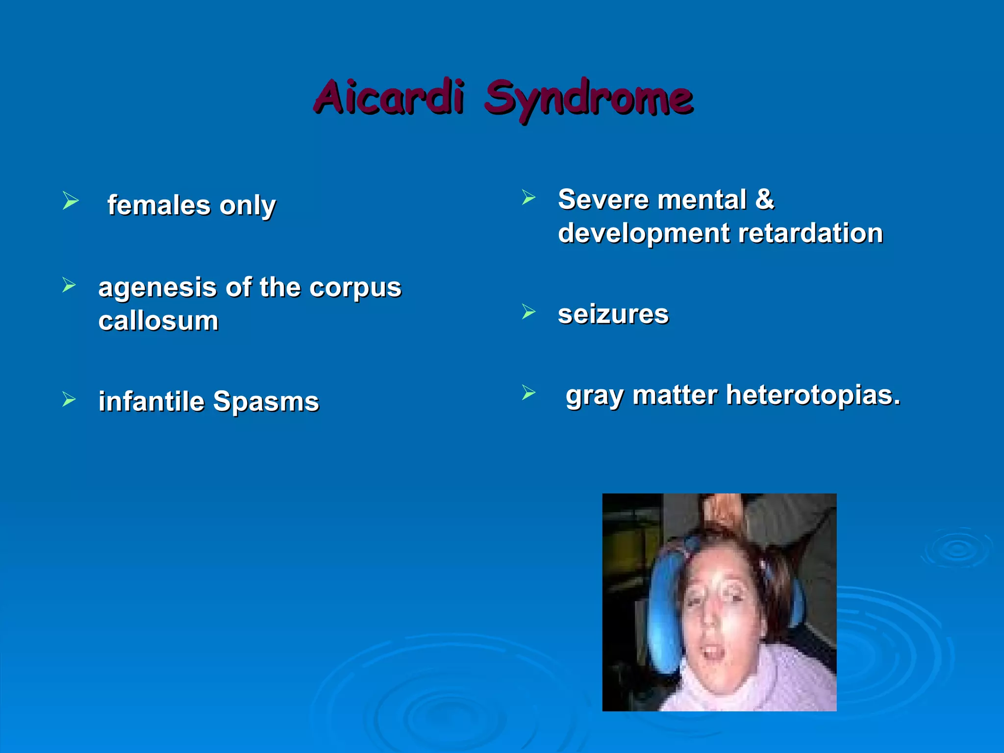 An approach to a chil with microcephaly | PPT