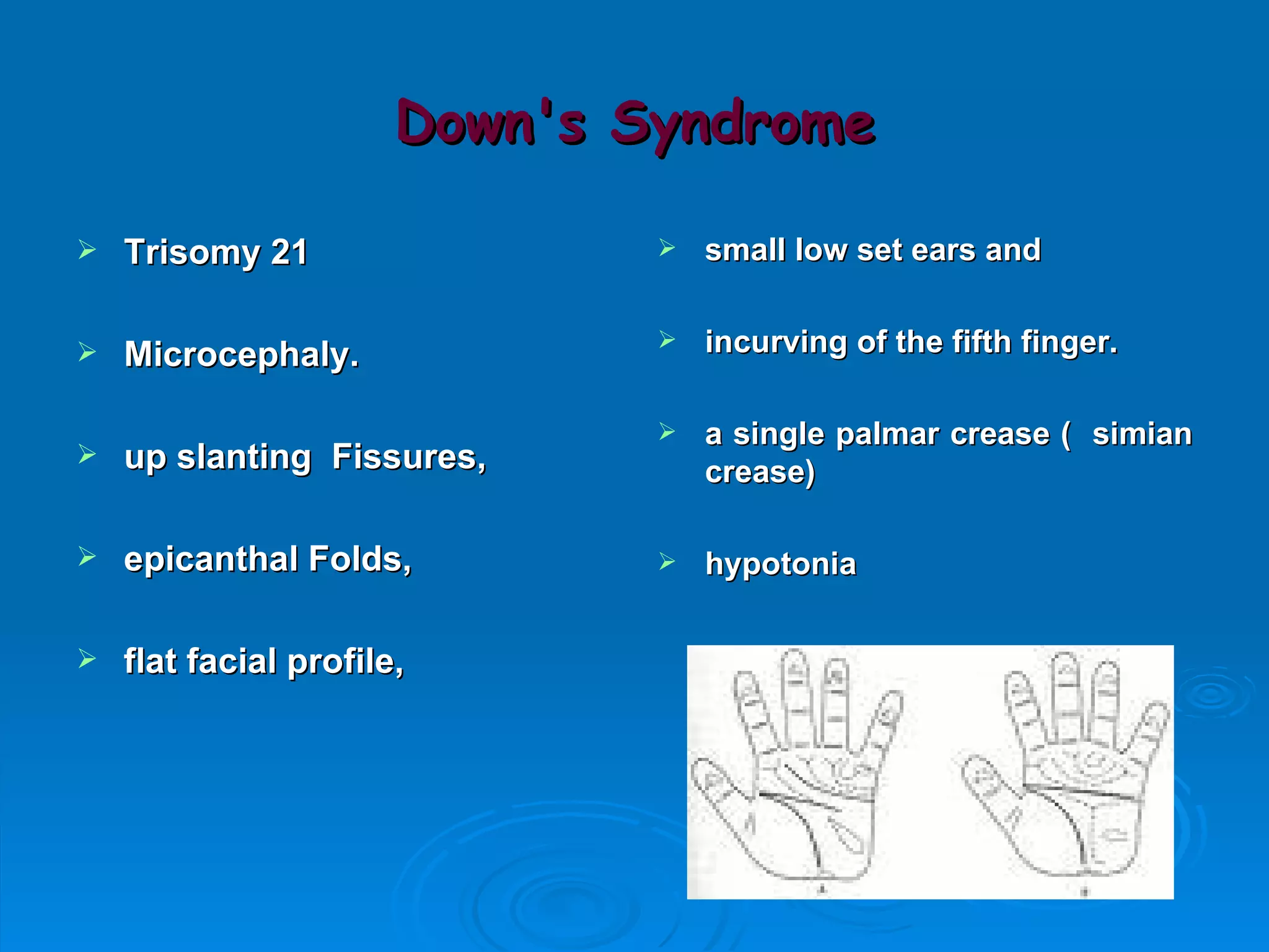 An approach to a chil with microcephaly | PPT