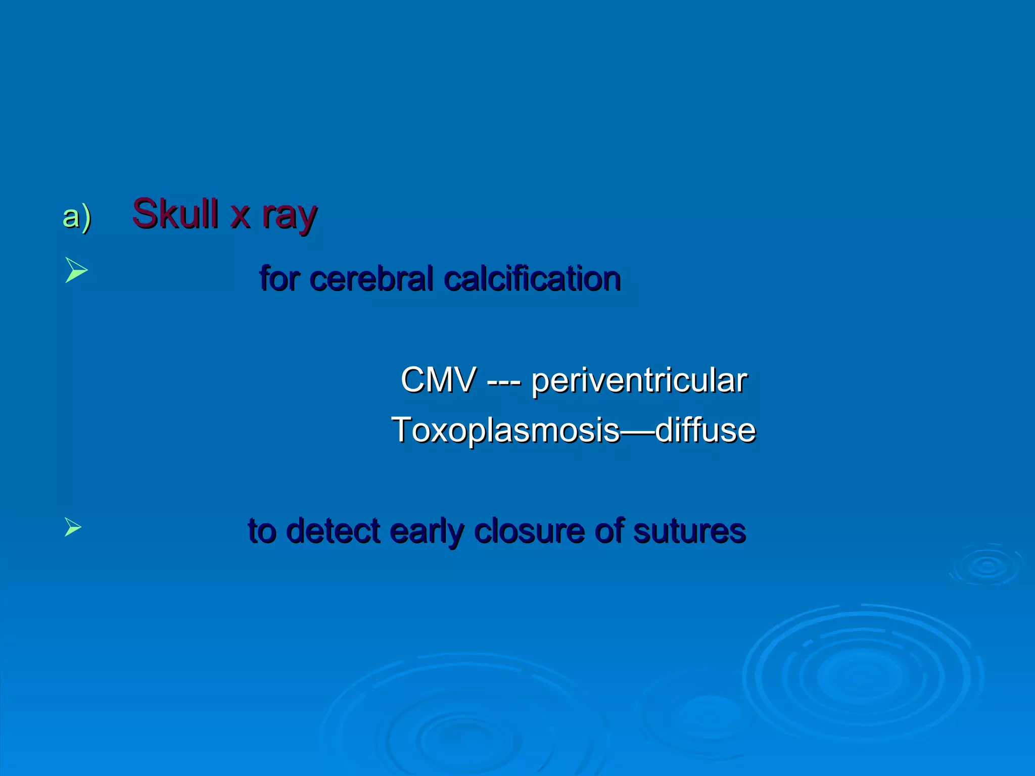An approach to a chil with microcephaly | PPT