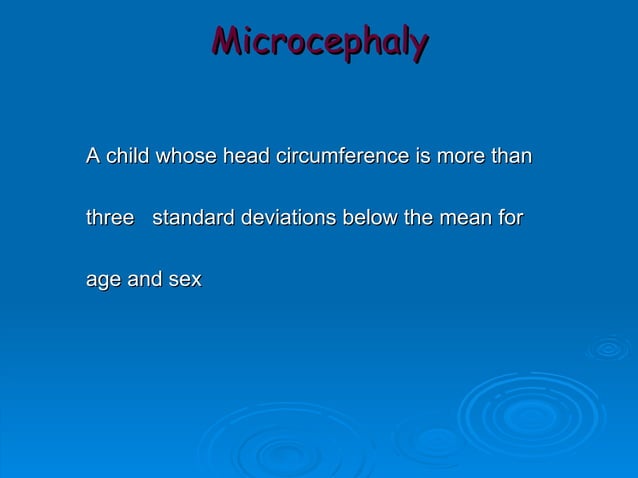 An approach to a chil with microcephaly | PPT
