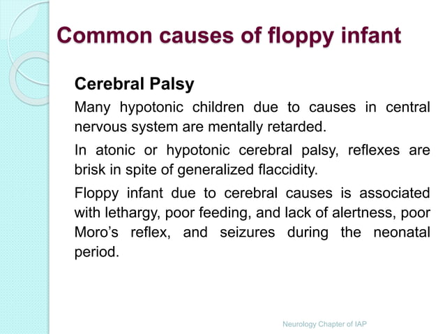 An approach to a Floppy infant - Dr Sujit | PPTX