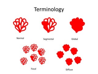 An approach to a kidney biopsy manan | PPT