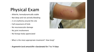 An approach to animal bites | PPTX