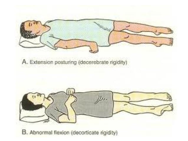 An approach to an unconscious patient | PPT
