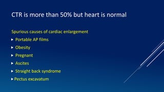 anapproachtocardiacxray-170203092148.pdf