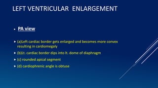 An approach to cardiac xray Dr. Muhammad Bin Zulfiqar | PPTX
