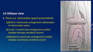 An approach to cardiac xray Dr. Muhammad Bin Zulfiqar | PPTX