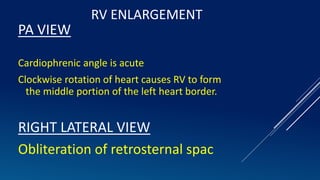 An approach to cardiac xray Dr. Muhammad Bin Zulfiqar | PPTX