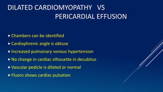 An approach to cardiac xray Dr. Muhammad Bin Zulfiqar | PPTX