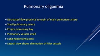 An approach to cardiac xray Dr. Muhammad Bin Zulfiqar | PPTX