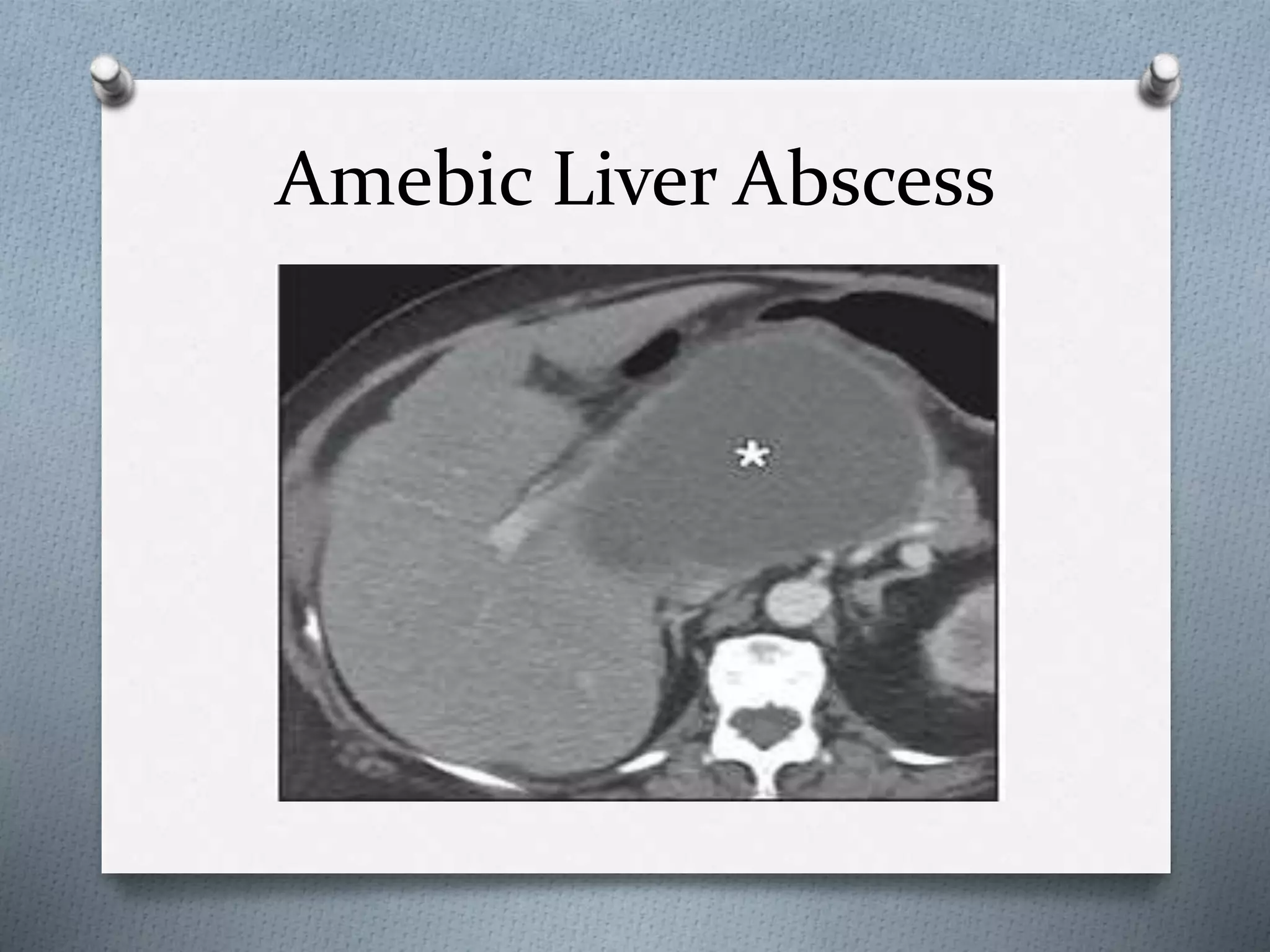 An approach to cystic hepatic lesions jk 05-aprl-2016 | PPTX