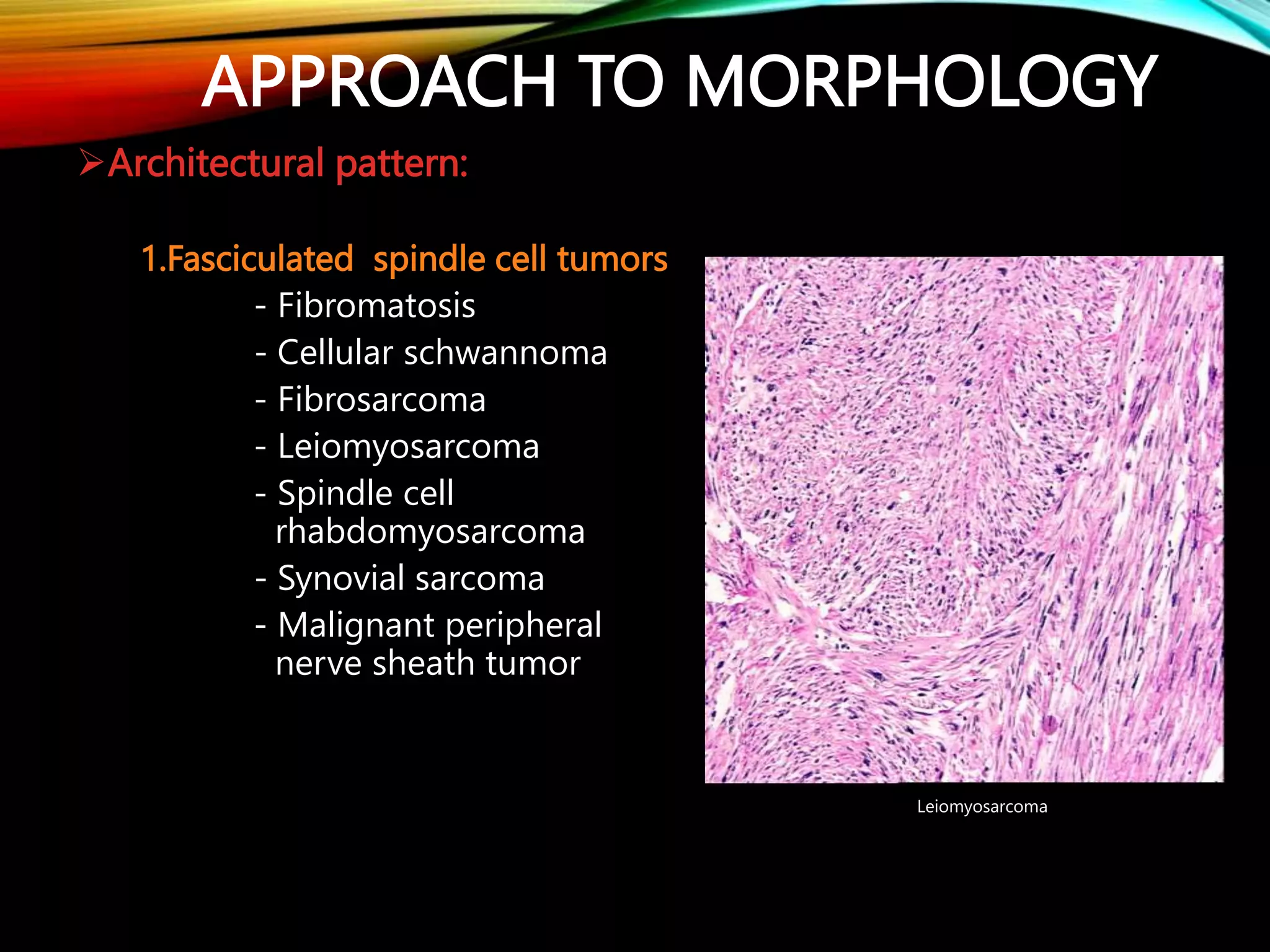 An approach to diagonosis of soft tissue sarcoma.pptx