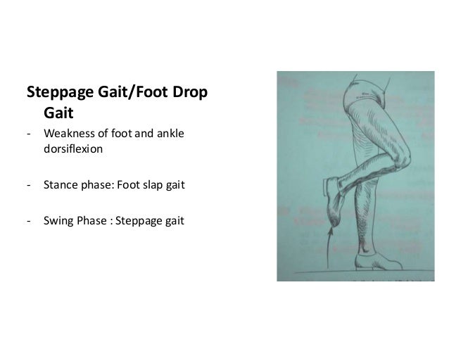 An approach to limping child