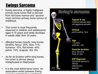 Sarcoma Bone Flat Bone