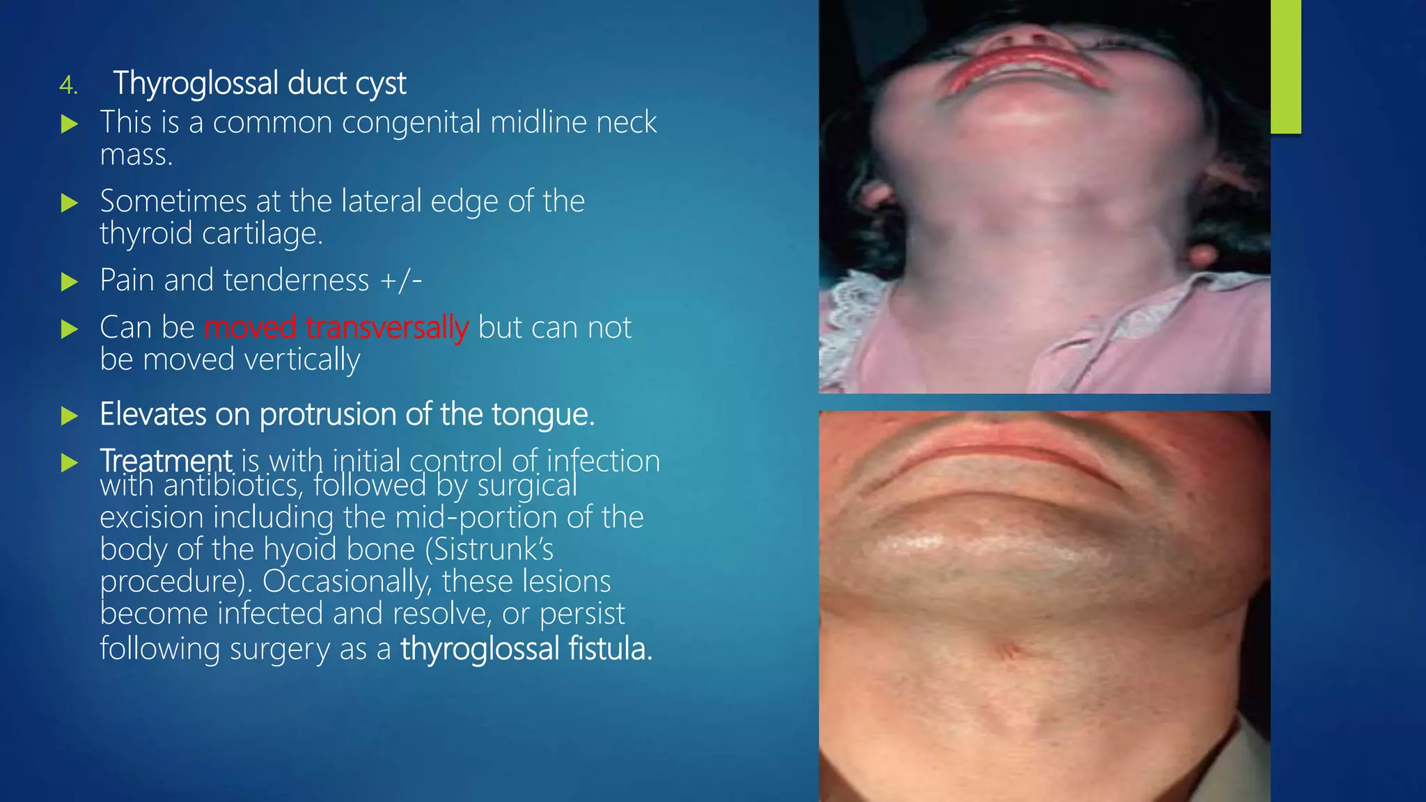 An approach to the neck mass | PPTX
