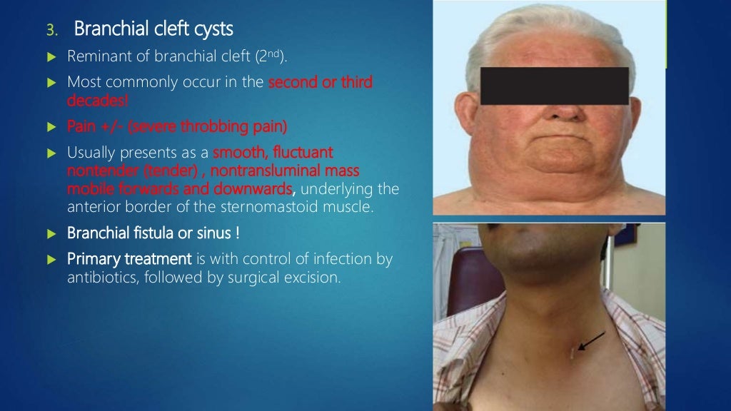 An approach to the neck mass