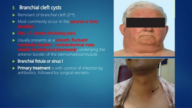 An approach to the neck mass