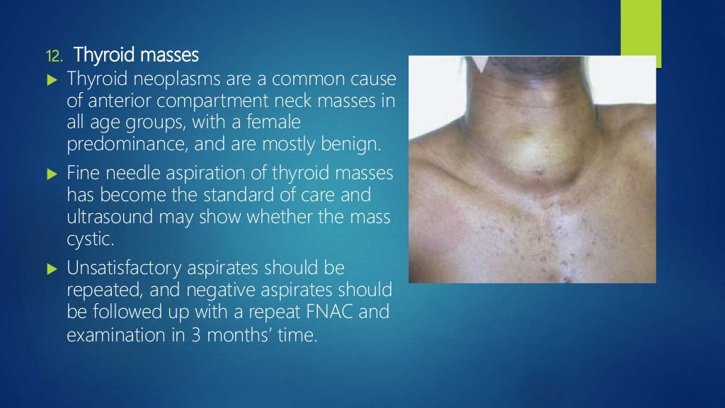 An approach to the neck mass