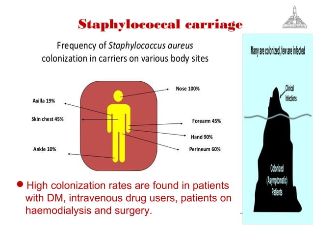 An approach to the patient with recurrent skin abscesses | PPT