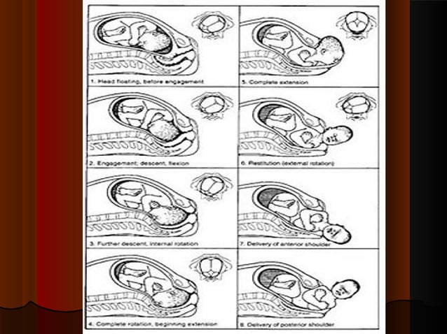 Ana proses persalinan-normal-eb1 (1) | PPT