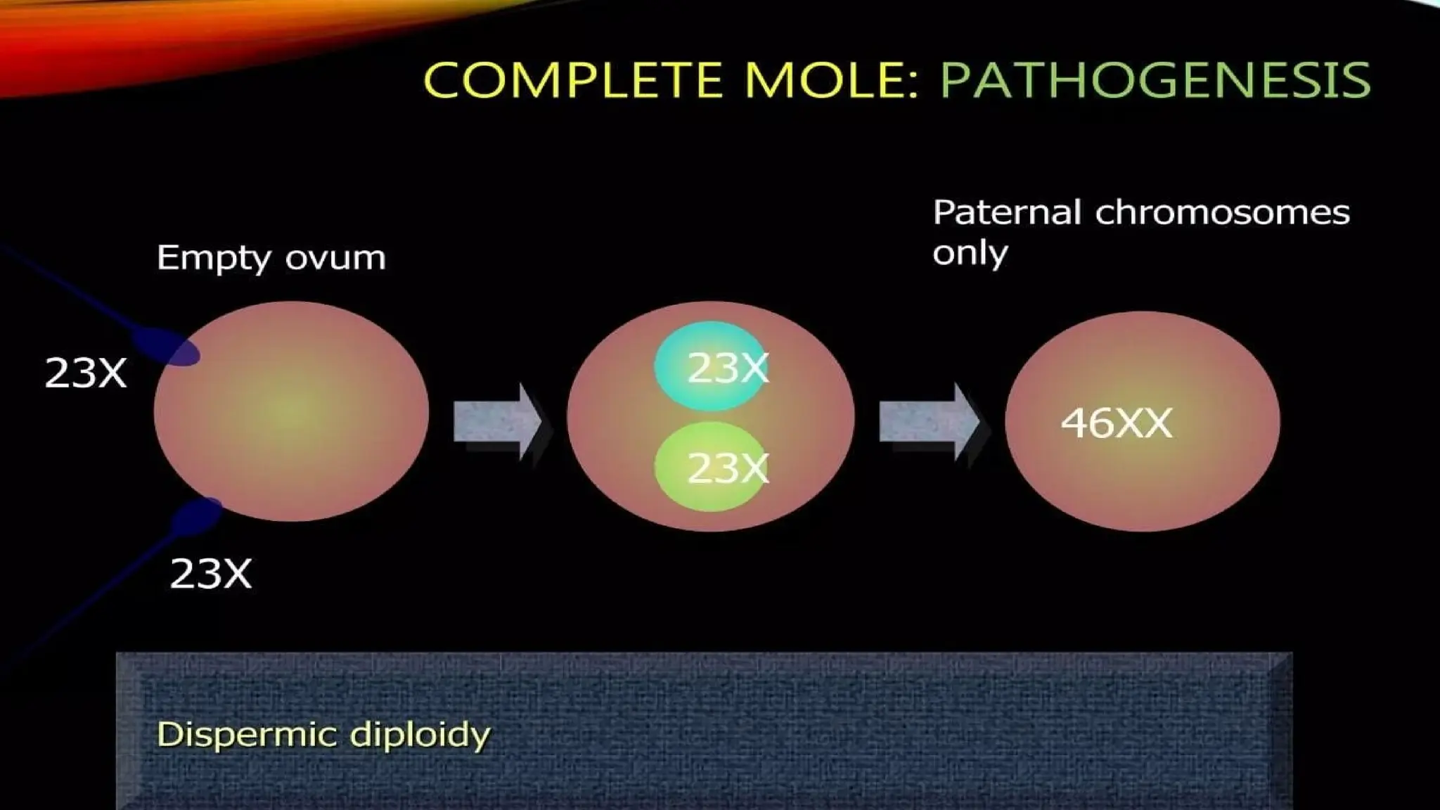 Obg gestational trophoblastic disease.ppt.2.pptx