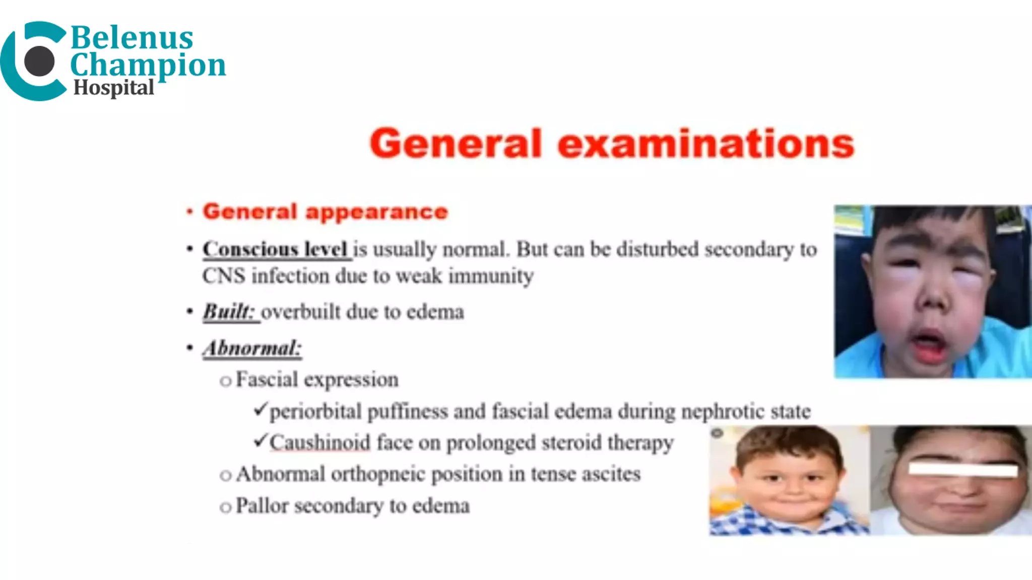 ANASARCA IN CHILDREN - WPS Office.pptx