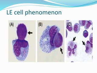 anti nuclear antibody | PPTX