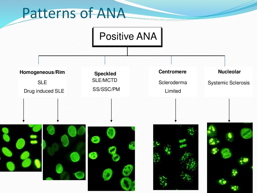 anti nuclear antibody